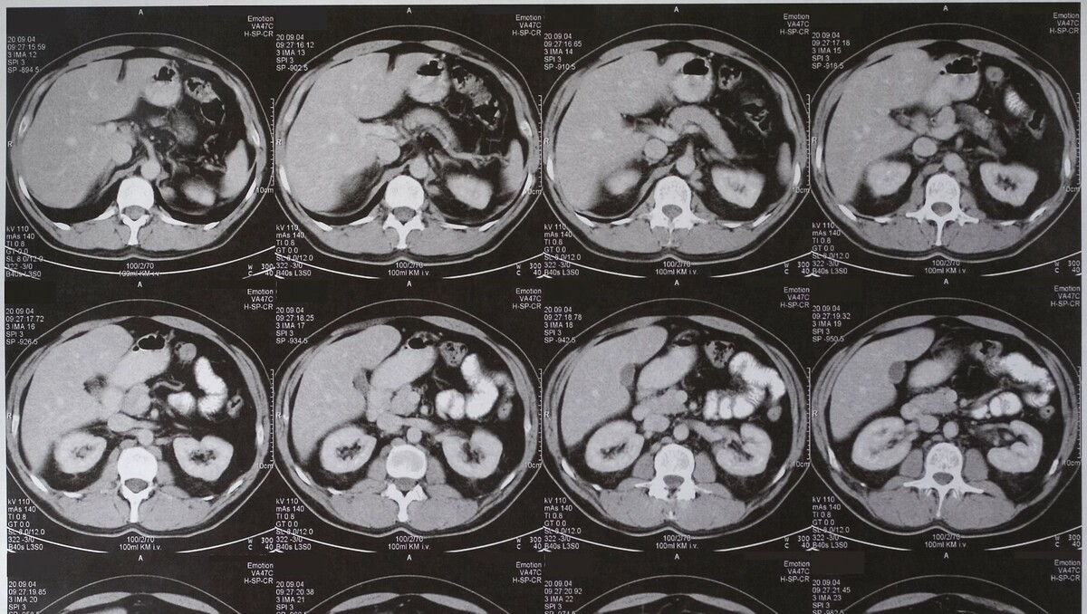 Resources - For Patients - FAQs: CT | Professional Radiology